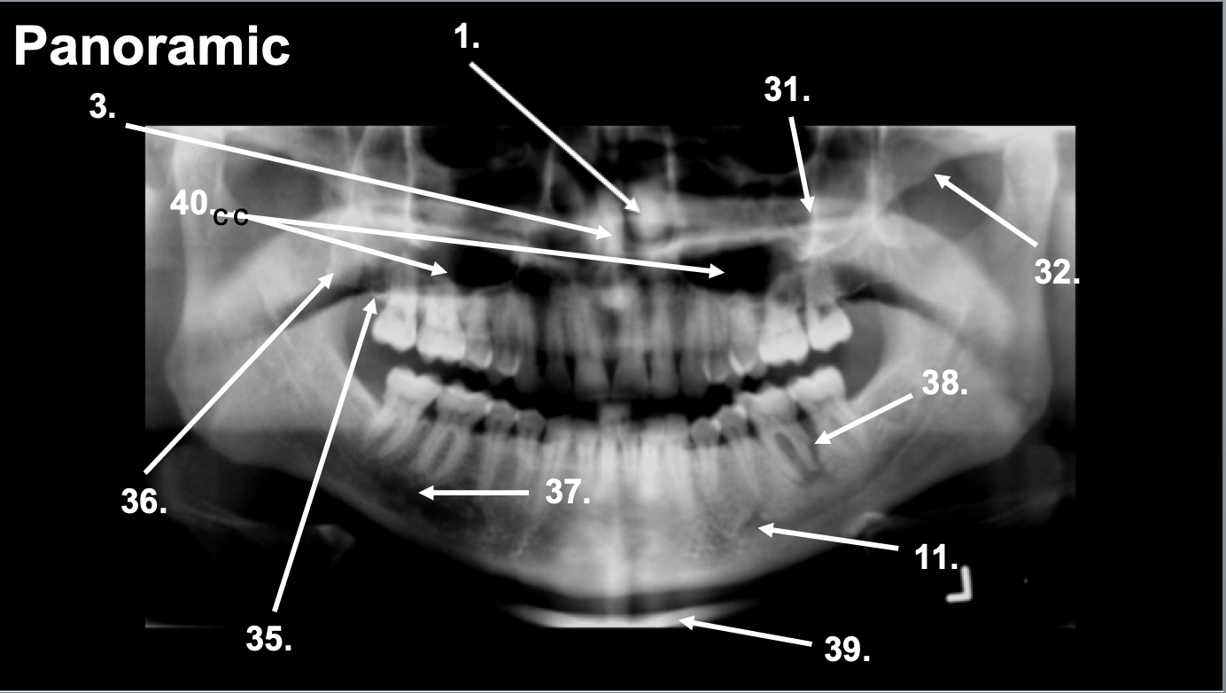 Praised, essential Radiology for Dental Hygienists2023